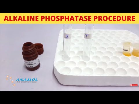 Alkaline Phosphatase Test | ALP Test