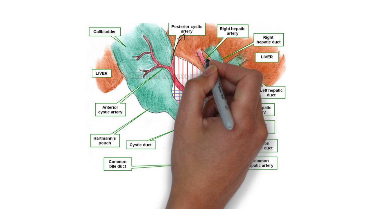 Cystohepatic triangle(calot's triangle) - YouTube