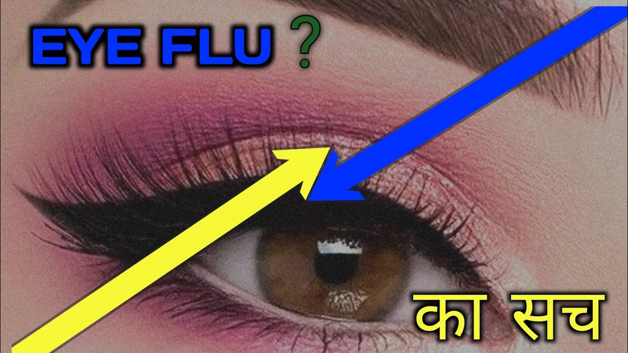 EYE FLU FULL CASE STUDY !! flu का संपूर्ण ज्ञान ।। - YouTube