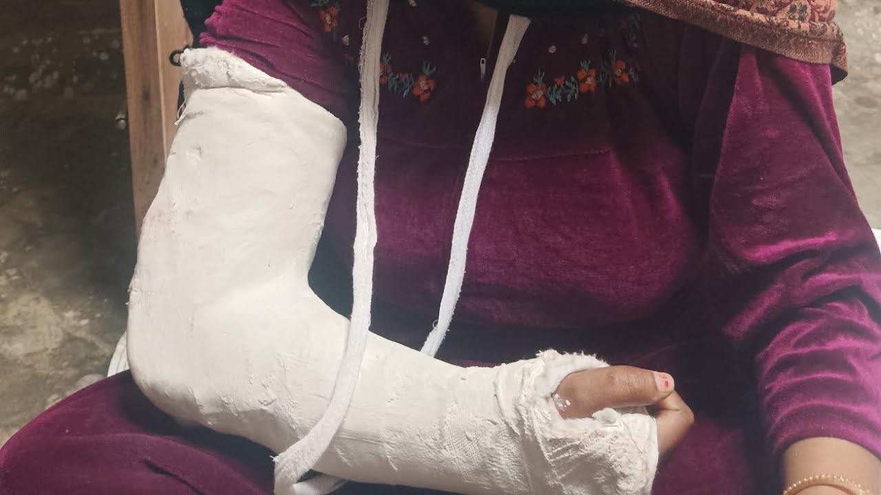 😱😭 Accident Ke Baad Hath Mein Plaster 😞 | Painful Day | Emotional Vlog ...