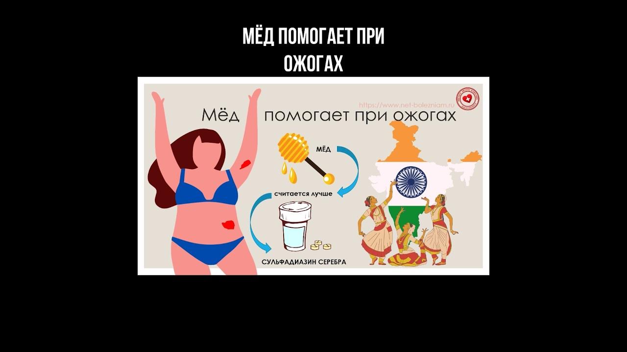 Мёд помогает при ожогах #мёд #ожоги #народнаямедицина #ожог - YouTube