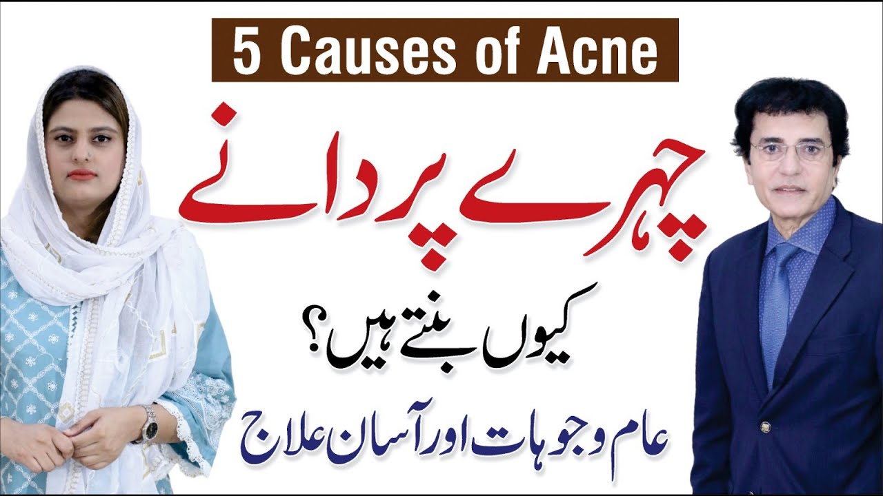 How to Cure Acne/Pimples Naturally at Home | Dr. Ali Kazmi ...