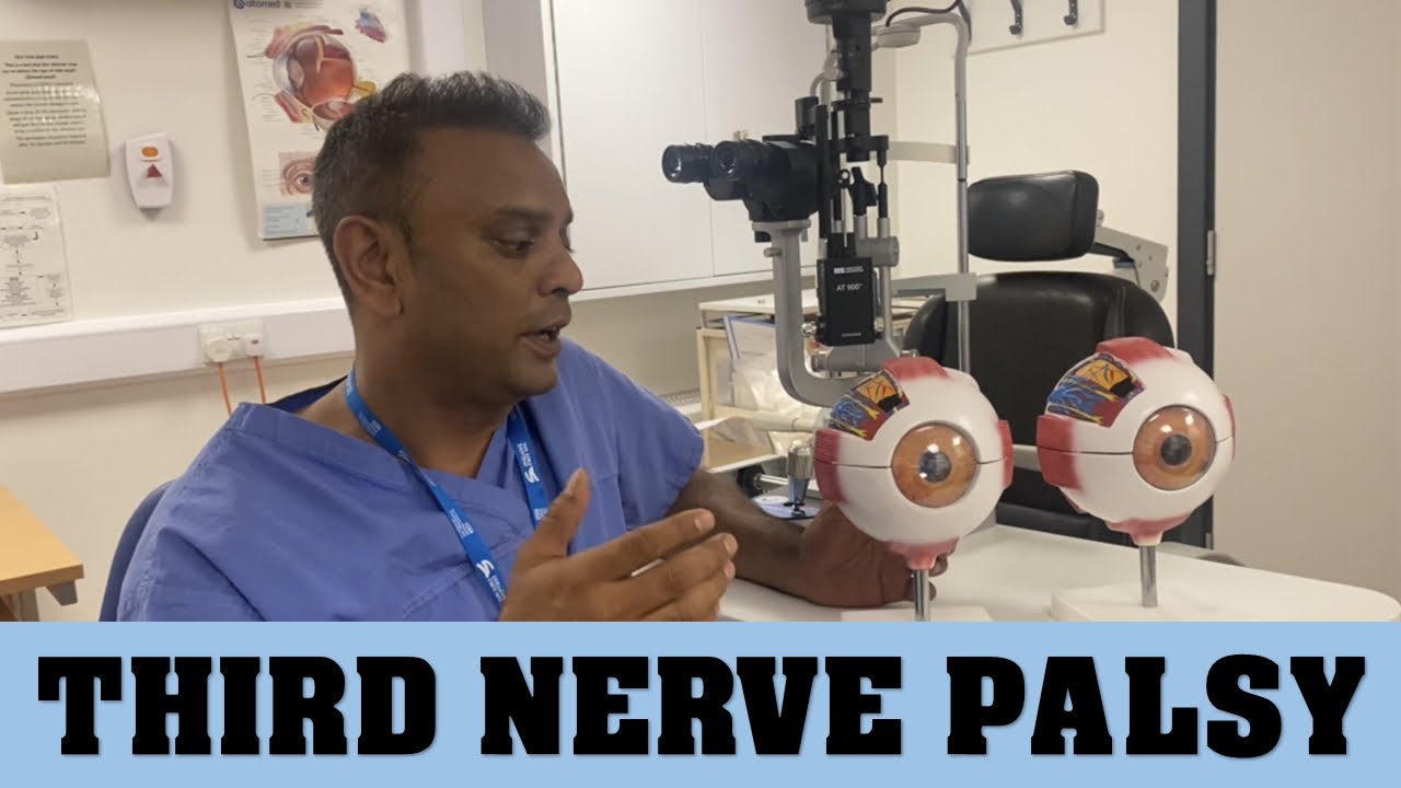 THIRD NERVE PALSY - YouTube