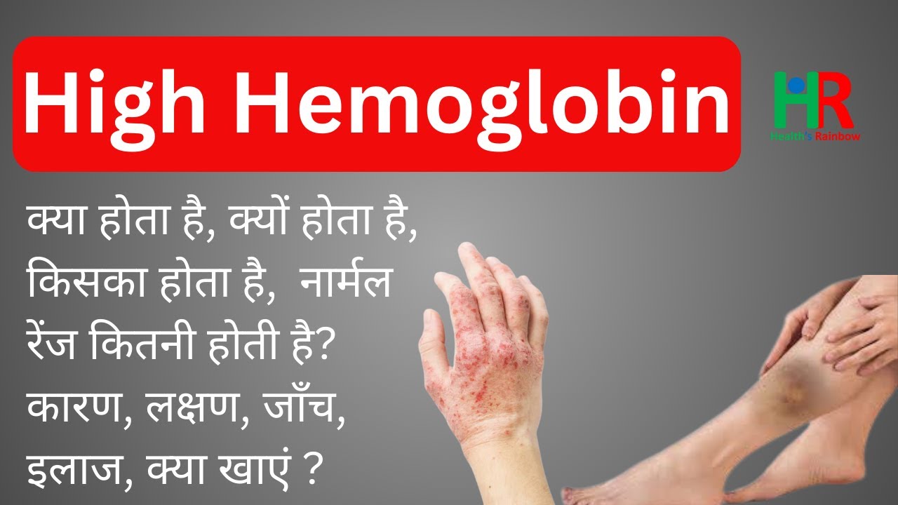 High Hemoglobin High Hemoglobin Causes High Hemoglobin Symptoms And