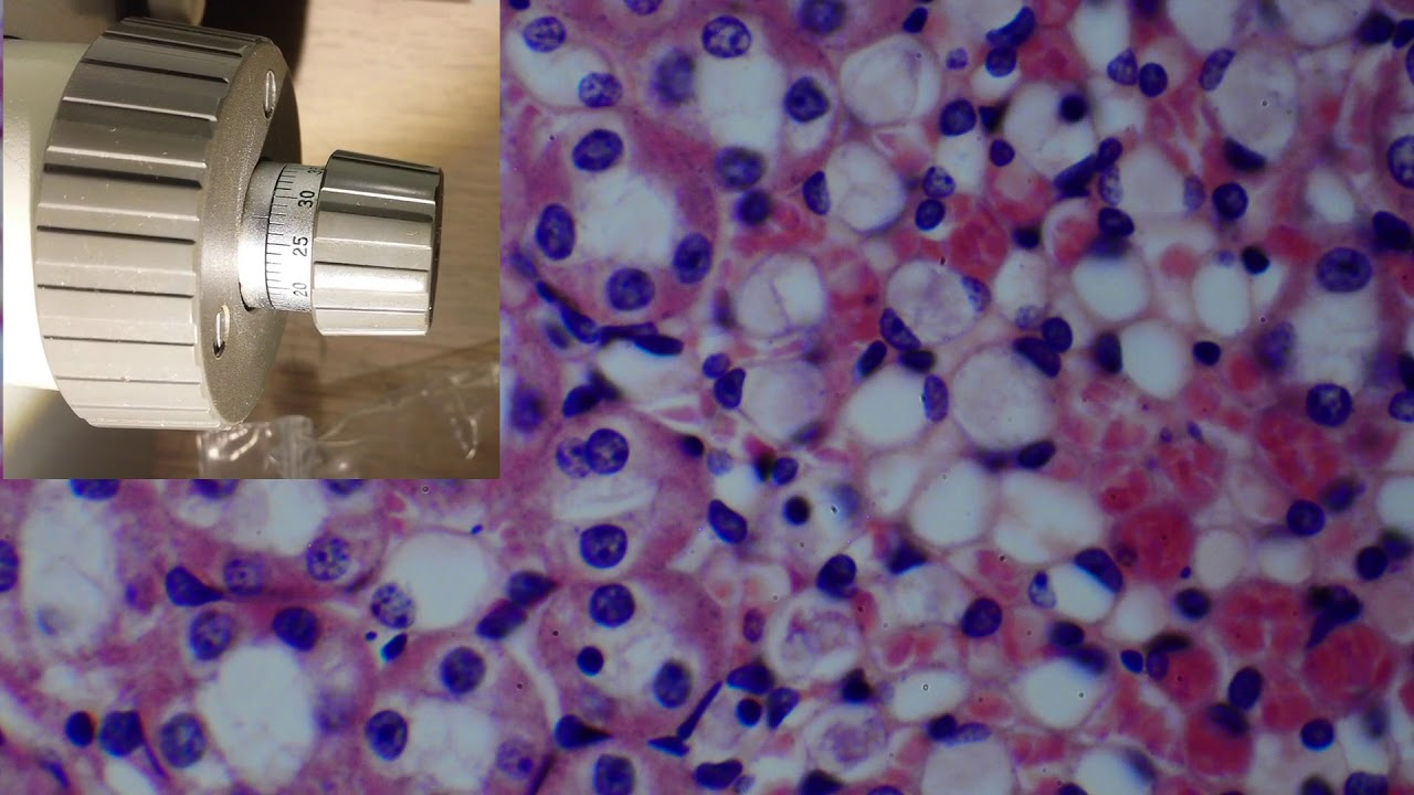 Arduino controlled focus stack demonstration (Docuval) - YouTube