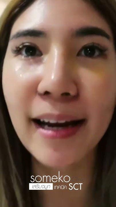 รีวิวเสริมจมูก #เสริมจมูก #someko - YouTube