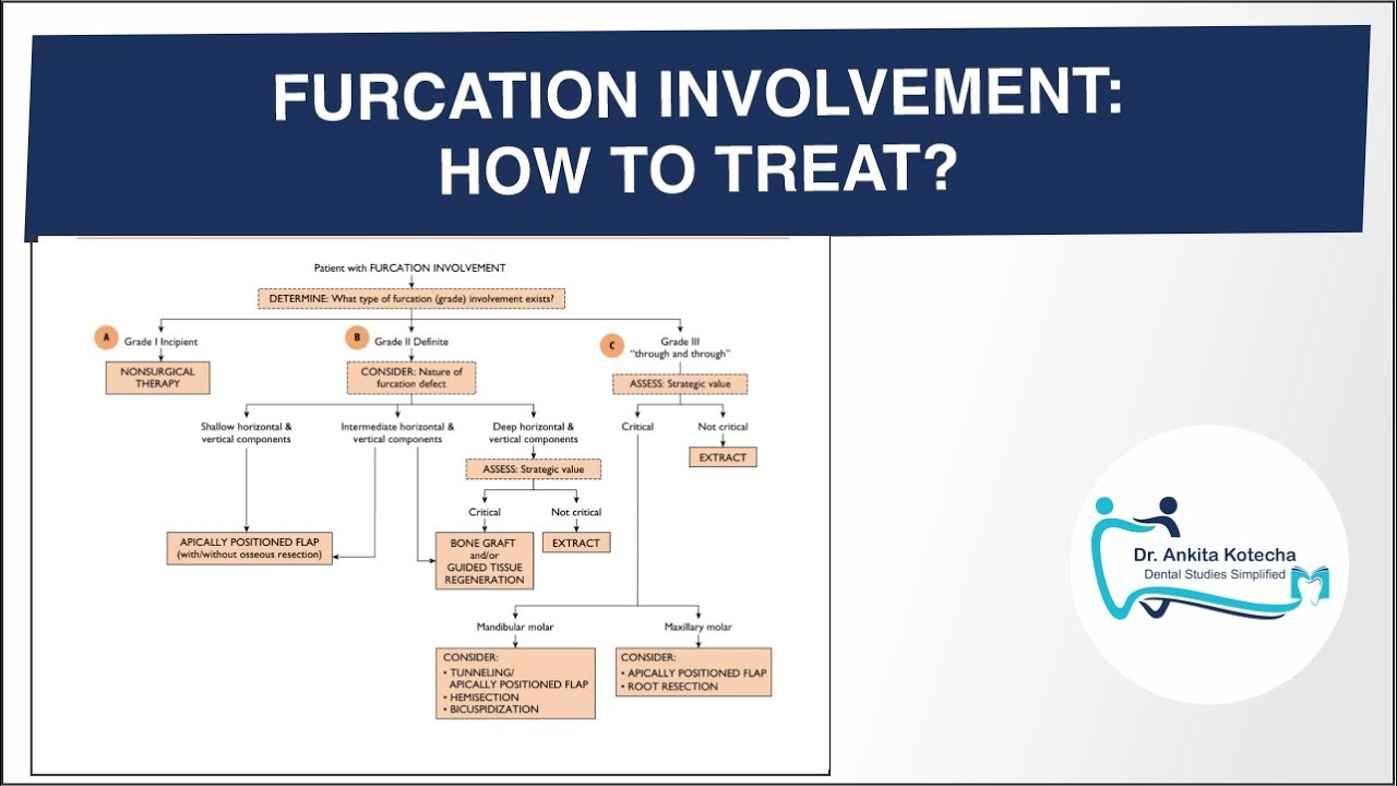 DECISION MAKING: FURCATION INVOLVEMENT: HOW TO TREAT?/ DR. ANKITA ...