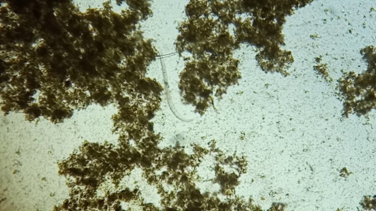 Larvae of Strongyles in an elephant (Elephas maximus) - YouTube