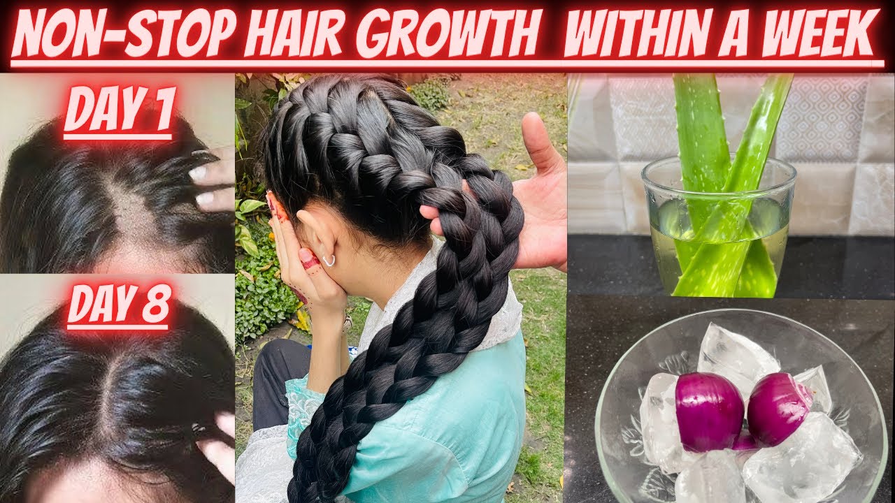 NON STOP HAIR GROWTH WITHIN WEEK || Accelerate Hair Growth At Rocket ...