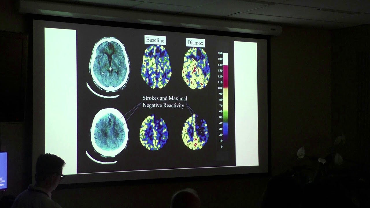 Howard Yonas, MD ("Making Decisions Without Data Is Called Guessing ...