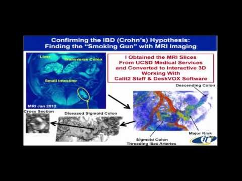 Larry Smarr - Quantifying The Dynamics of Your Superorganism Body Using Big Data Supercomputing