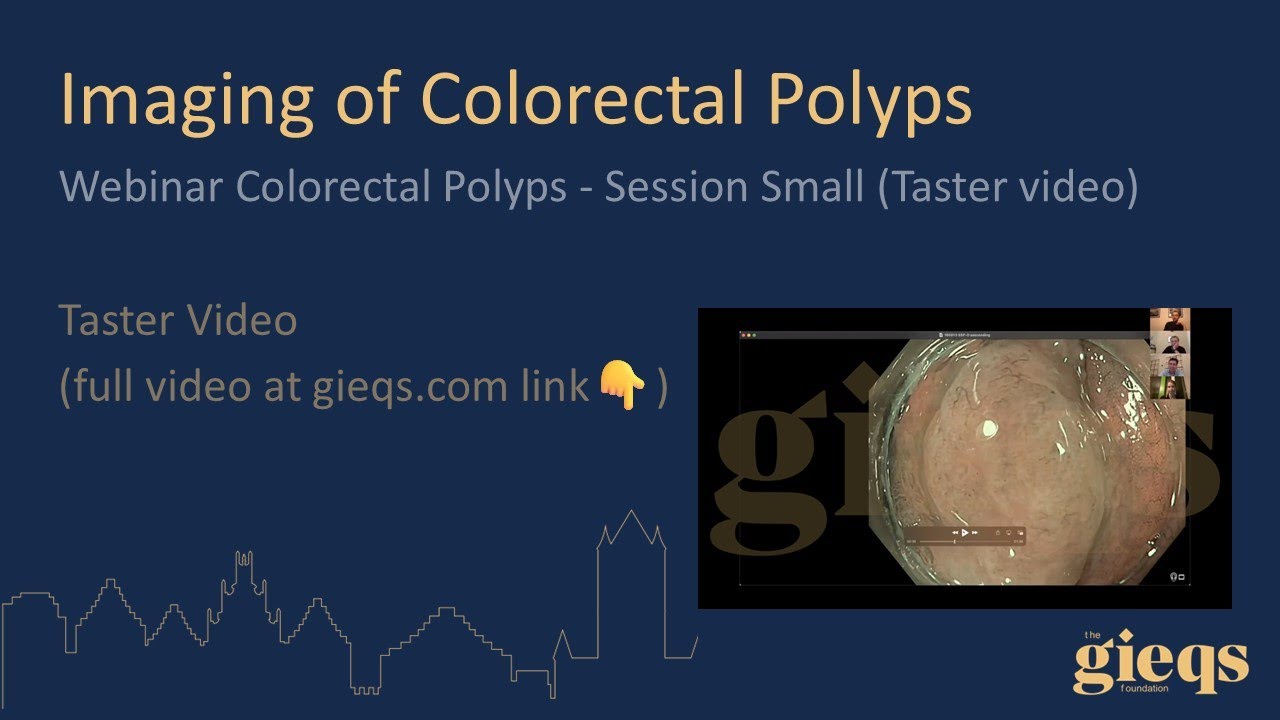 Webinar Colorectal Polyps - Session Small (Taster video) - YouTube