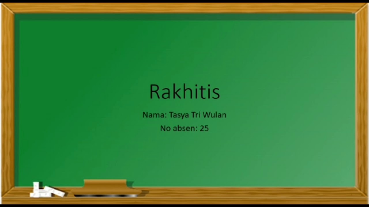 penyakit rakhitis pada anak - YouTube