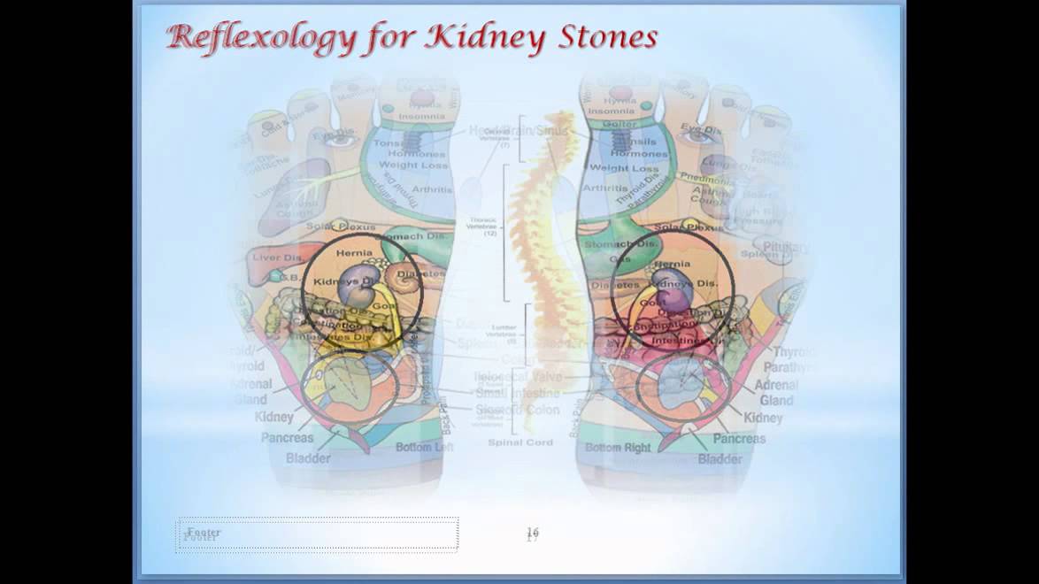 Dr. P. Sivagnanam's presentation on Stones in Human Body - YouTube