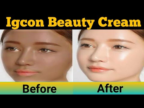 Igcon beauty Cream uses in Hindi l Igcon beauty cream Side effects in ...