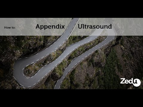 How to: Appendix Ultrasound - Zedu POCUS Coaching Corner - 4 March 2021 ...
