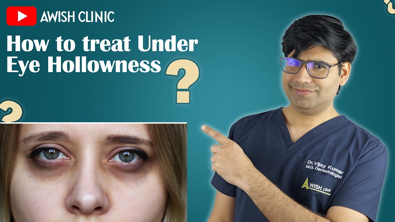 The Miracle Solution to Get Rid of Under Eye Hollowness! - YouTube