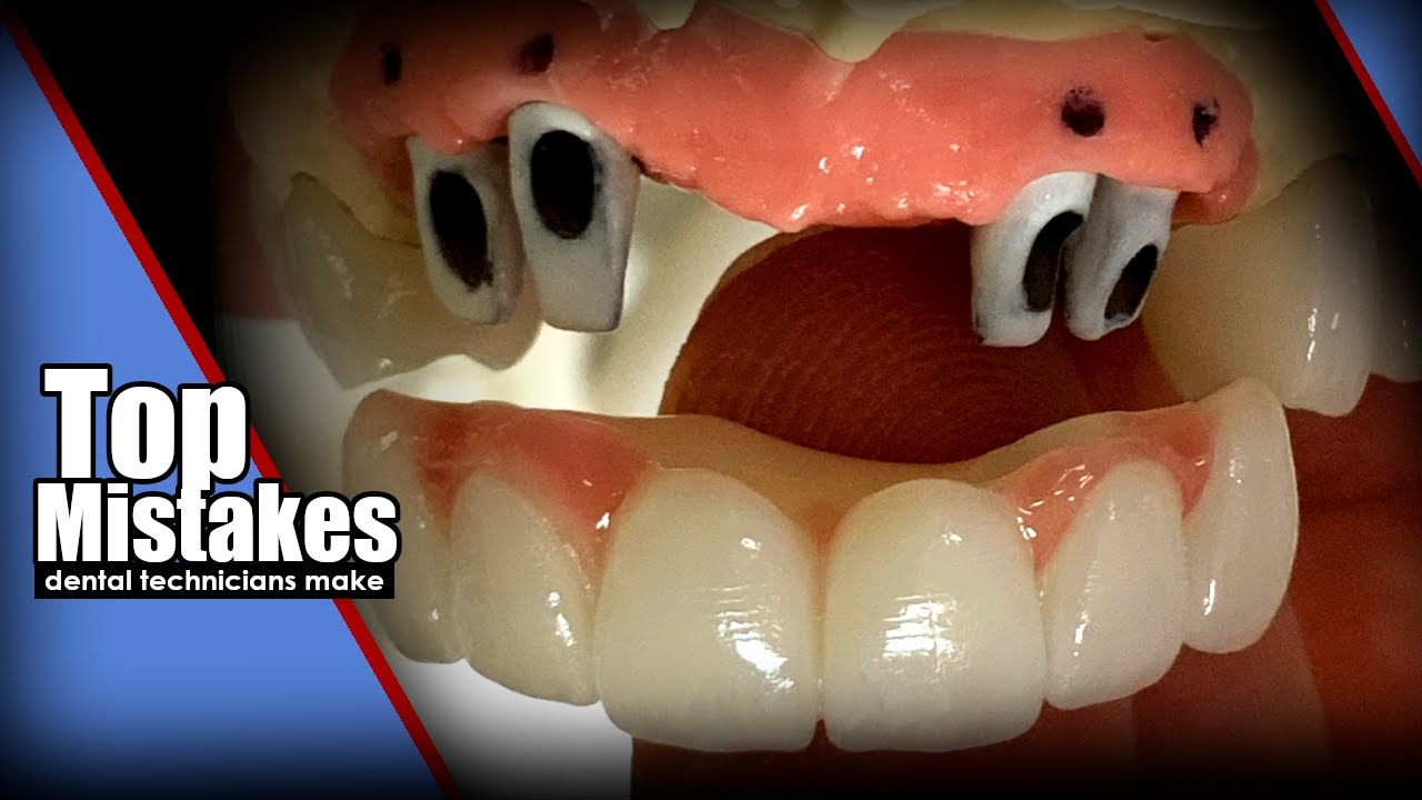 Top Mistakes Dental Technicians Make Episode 1 - YouTube