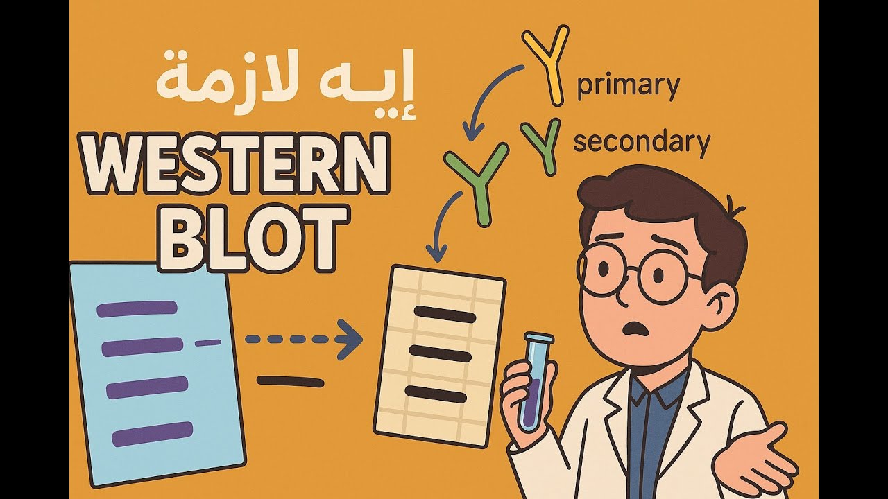 western plot techinque (شرح بالعربي) - YouTube