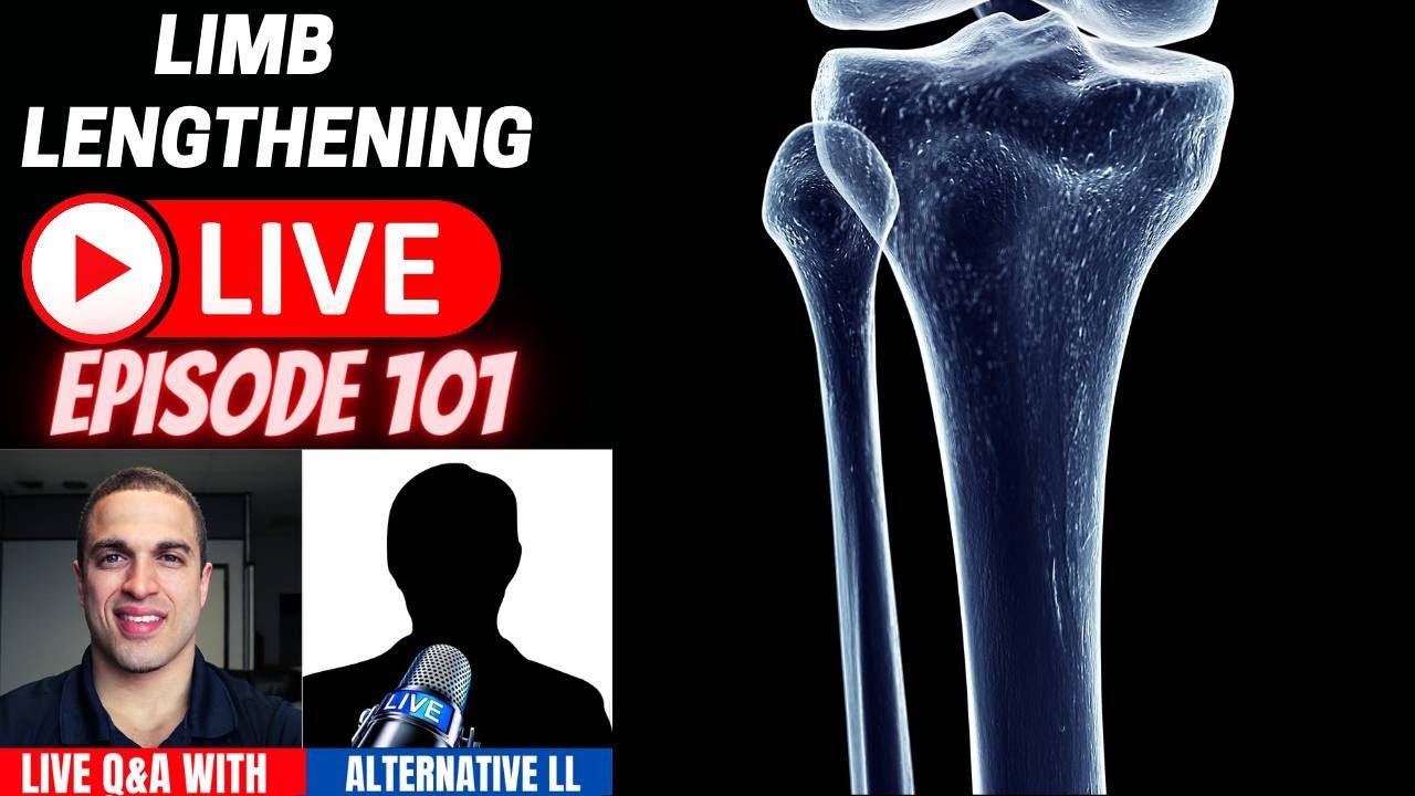 Limb Lengthening LIVE Episode 101 - Alternative Limb Lengthening ...