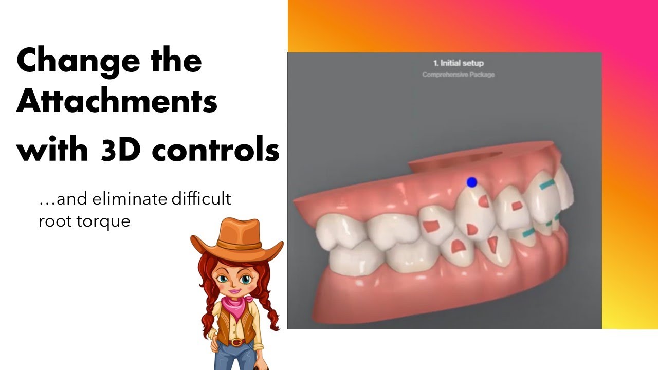 Invisalign ClinCheck - Changing attachments with 3D controls - YouTube