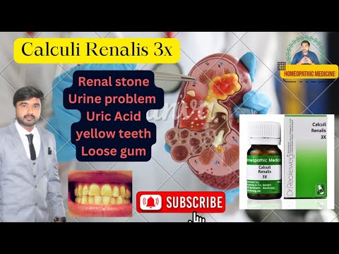 CALCULUS RENALIS | A Remedy made from Renal Stones @homeoTec # ...