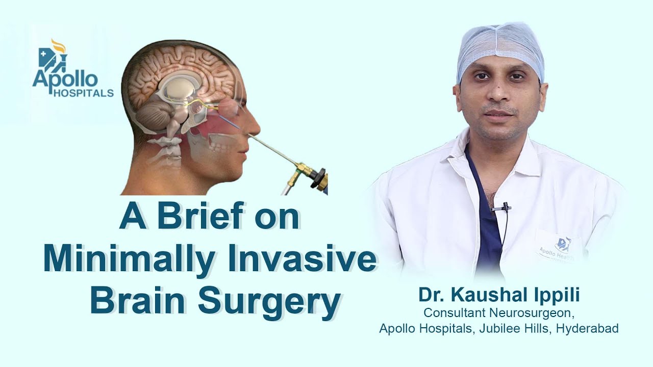 A Brief on Minimally Invasive Brain Surgery | Dr. Kaushal Ippili ...