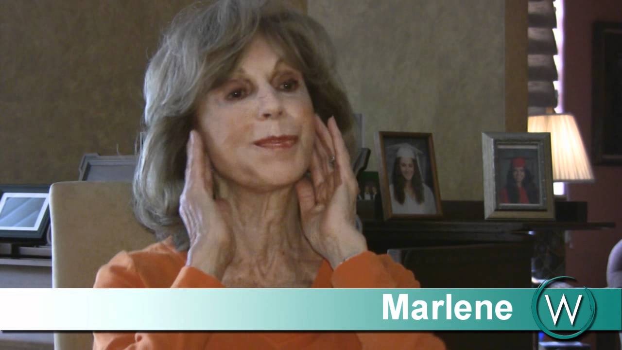 Marlene's Facelift W Cosmetic Surgery - YouTube