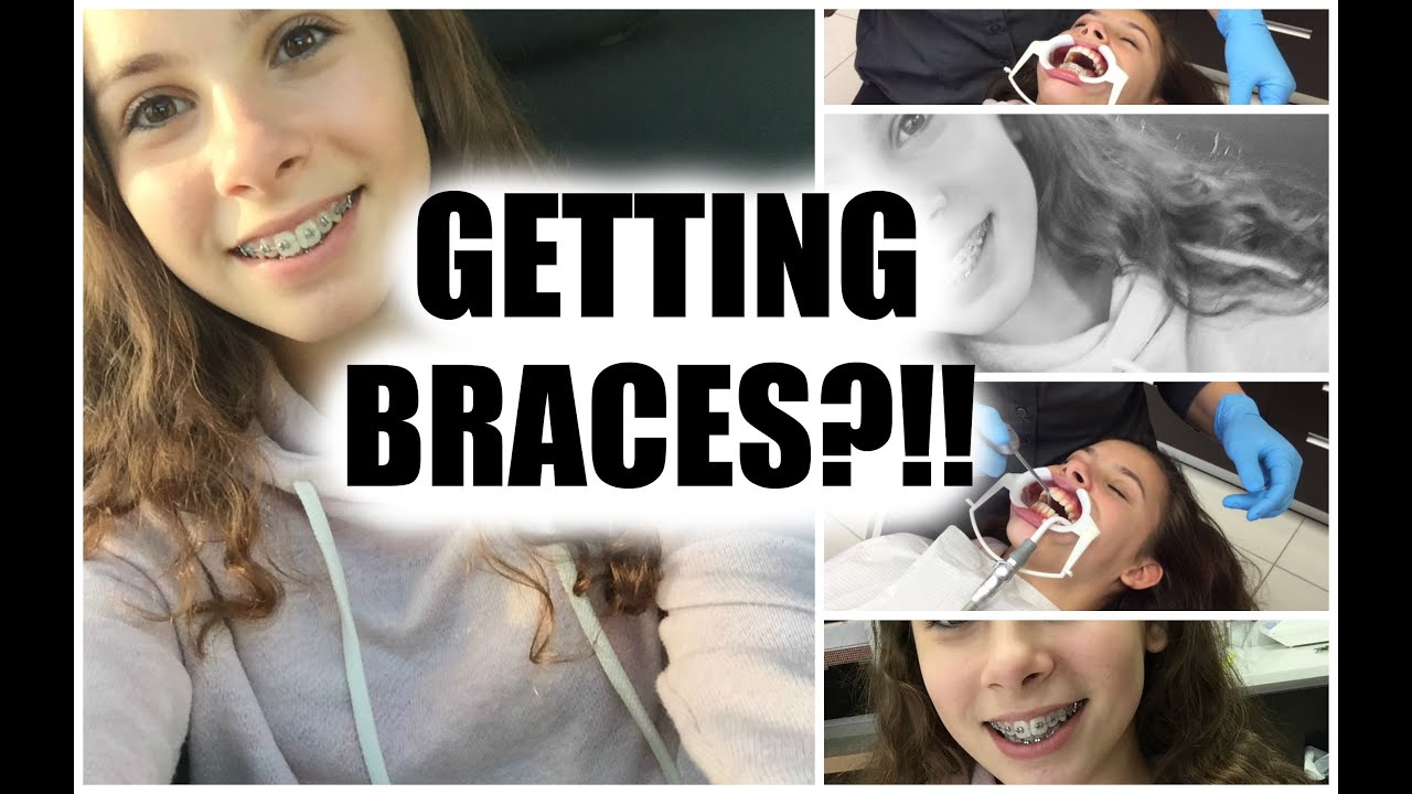 GETTING BRACES?! - YouTube