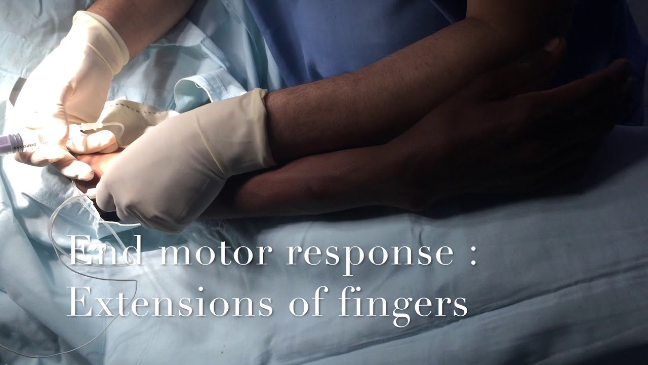 ELBOW BLOCK FOR FOREARM PLATTING - YouTube