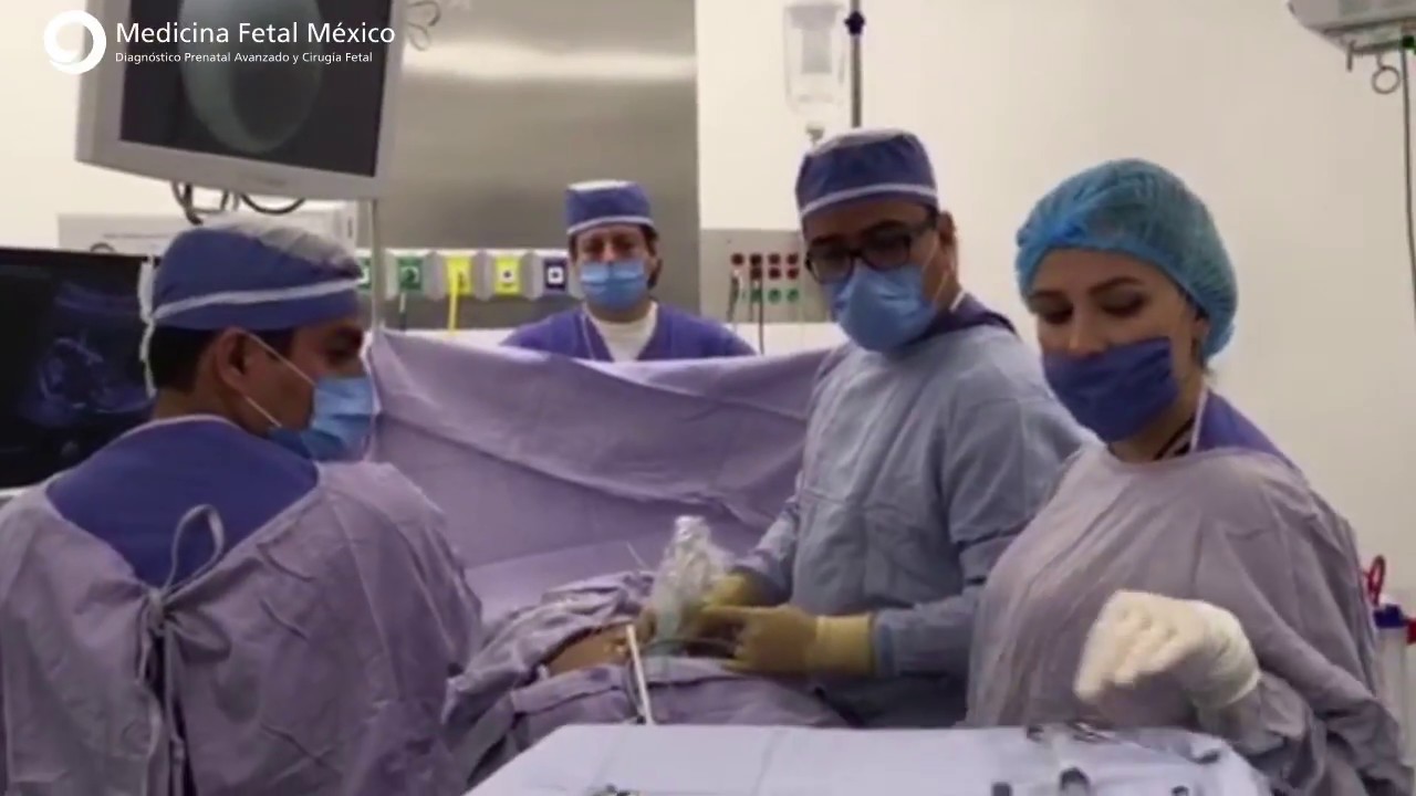 Cistoscopia Fetal realizada por el equipo de Medicina Fetal México ...