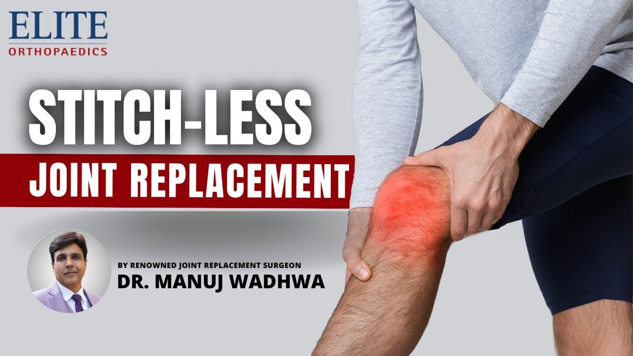 The Evolution of Stitch-less Joint Replacement: Expert insides by ...