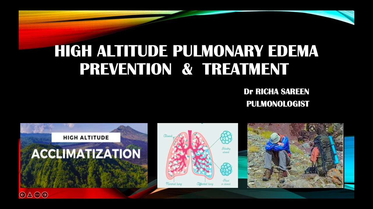 High altitude pulmonary edema/ Acute mountain sickness: prevention and ...