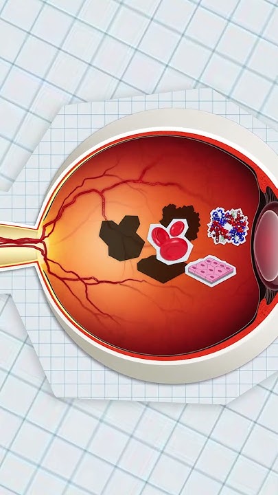 FLOATY THINGS IN YOUR EYE EXPLAINED - YouTube