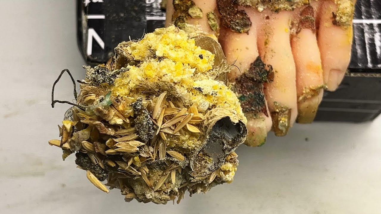 CUT Ingrown Toenails, Toenails with Maggots, Fungal Toenails ...