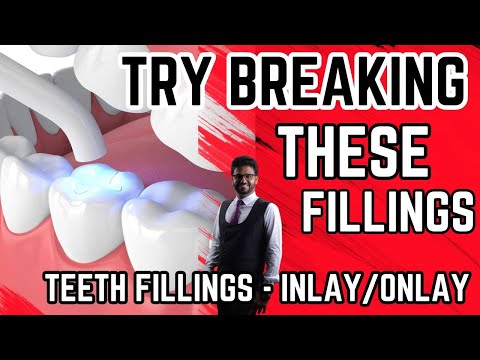 Teeth fillings which do not break/Why teeth fillings falling out/ Inlay ...