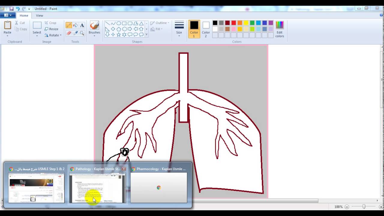 pathology - Respiratory ch15 (1) -- ATELECTASIS - YouTube