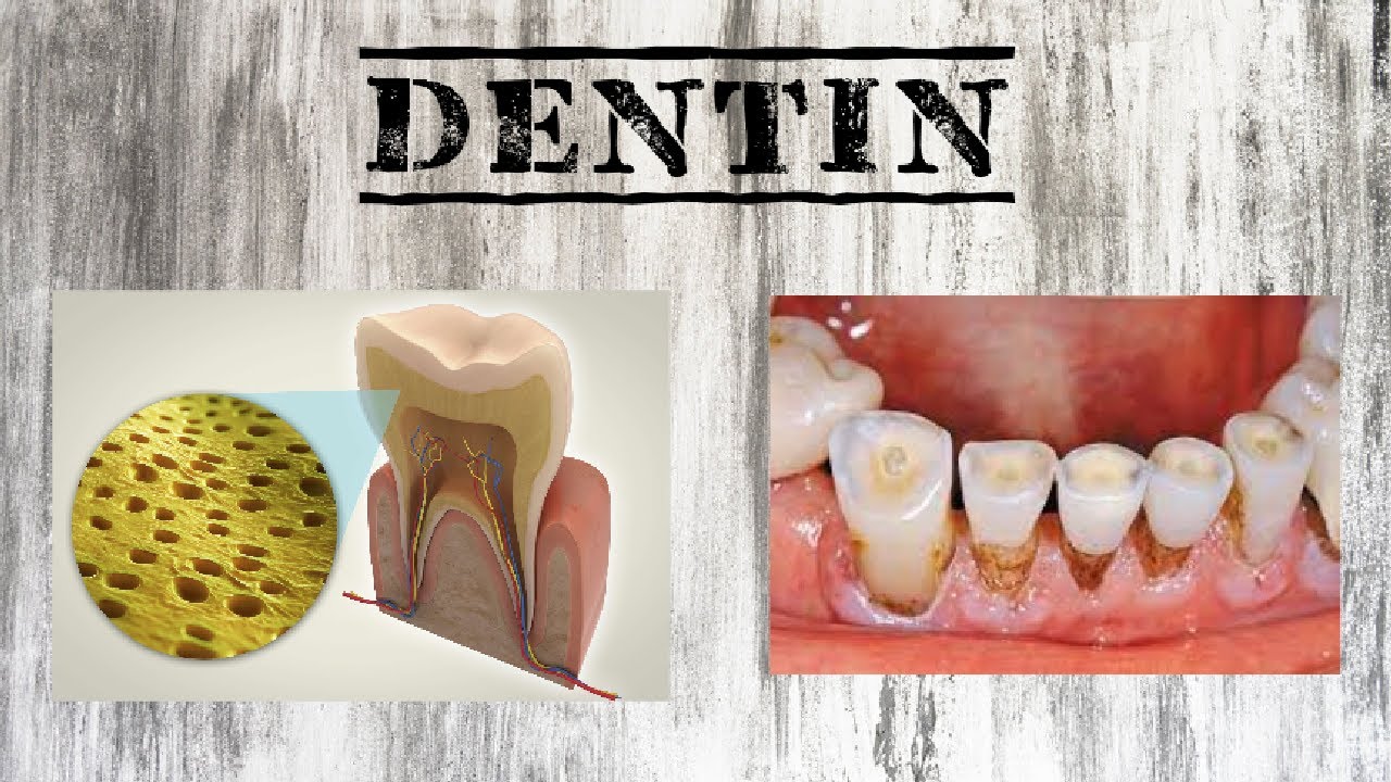 DENTIN HISTOLOGY || PART 1: STRUCTURE || #madeeasy #dentinhistology # ...