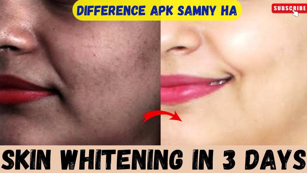 Skin Whitening Cream|Formula Night Whitening Cream|Instant Skin ...
