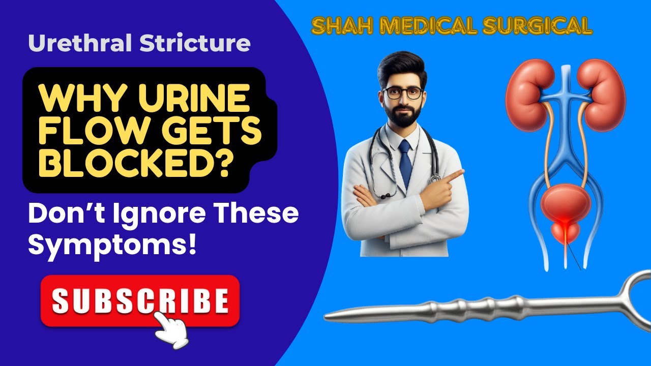 What is Urethral Stricture? Causes, Signs & Treatment Options ...
