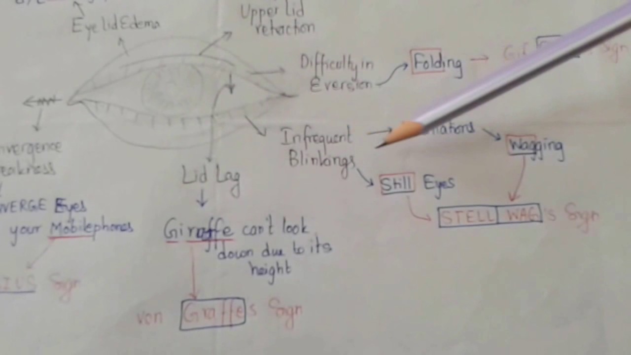 Thyroid Eye Disease Signs (Ophthalmopathy) || Mnemonics - YouTube