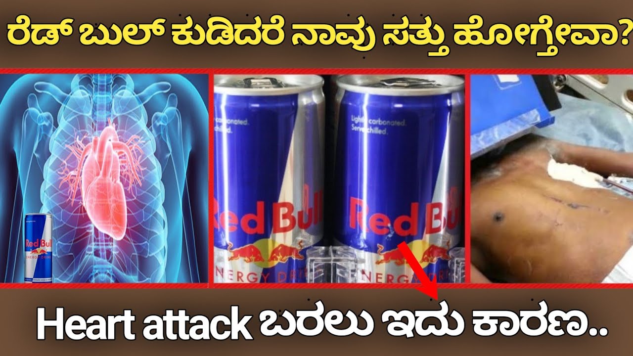 ರೆಡ್ ಬುಲ್ ಕುಡಿದ್ರೆ Heart Attack ಬರುತ್ತಾ? Can Red bull cause for heart ...