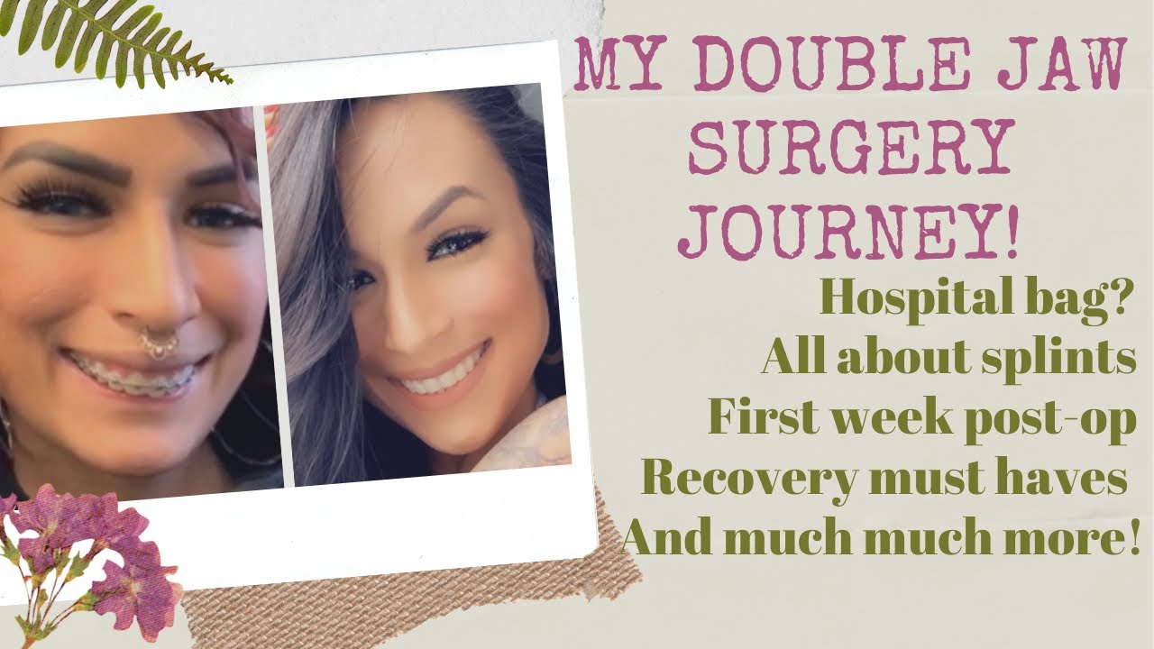 My Double Jaw Surgery Journey Experience 😃 - 10 months post-op - YouTube