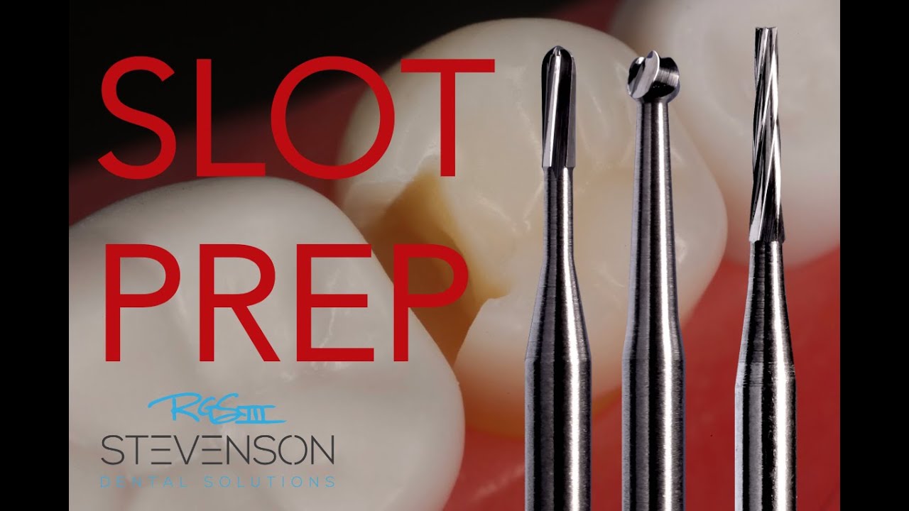 Class II - The Slot Preparation #20 DO Acadental | Dr. Richard ...