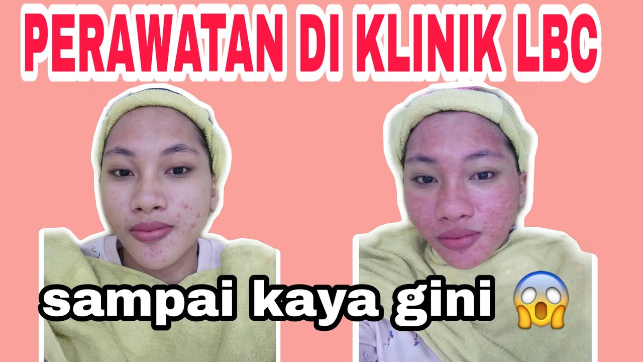 Klinik Lbc - Perumperindo.co.id