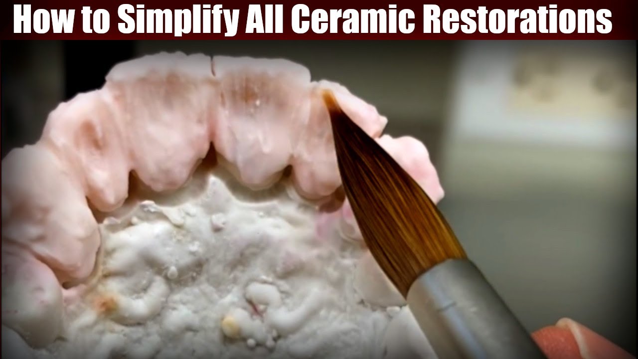 How to Simplify All Ceramic Restorations | 모든 세라믹 복원을 단순화하는 방법 - YouTube