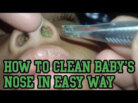How to clean baby's nose in easy ways - YouTube