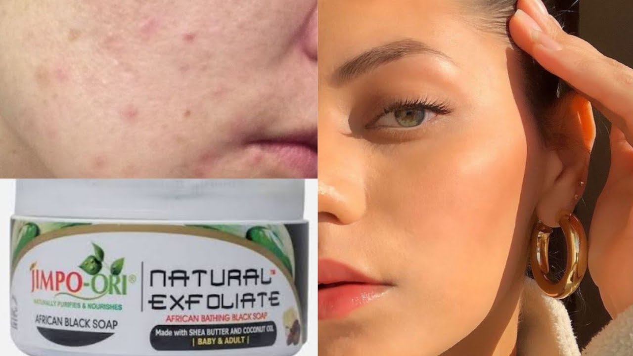 How to get a glowing skin with jimpo Ori black soap pt2 #skincare - YouTube