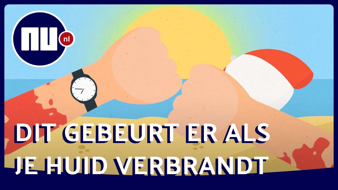 Verbrand na een dagje zon: 'Dit gebeurt er met je huid' | NU.nl - YouTube