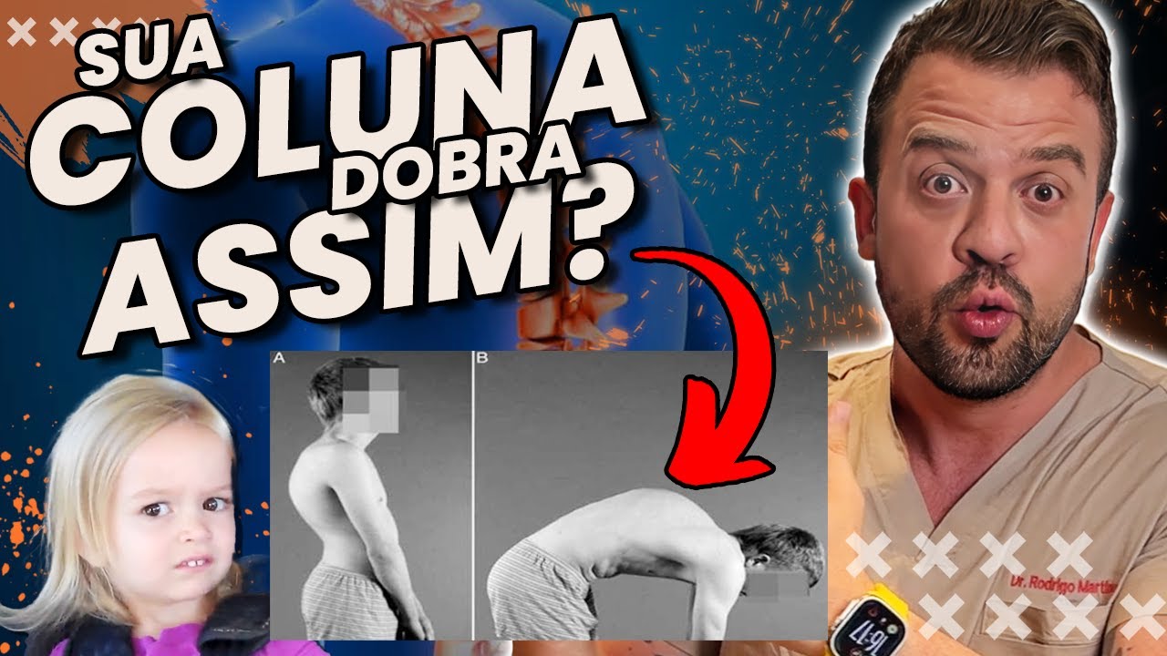 Doença de Scheuermann: O Que é e Como Tratar Essa Condição Que Afeta ...